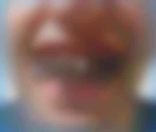 100 Exaggerated Facial Feature Renderings