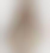 59 Creative and Crazy Rings