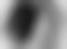 Watches that Monitor Laziness: Exmocare BT2