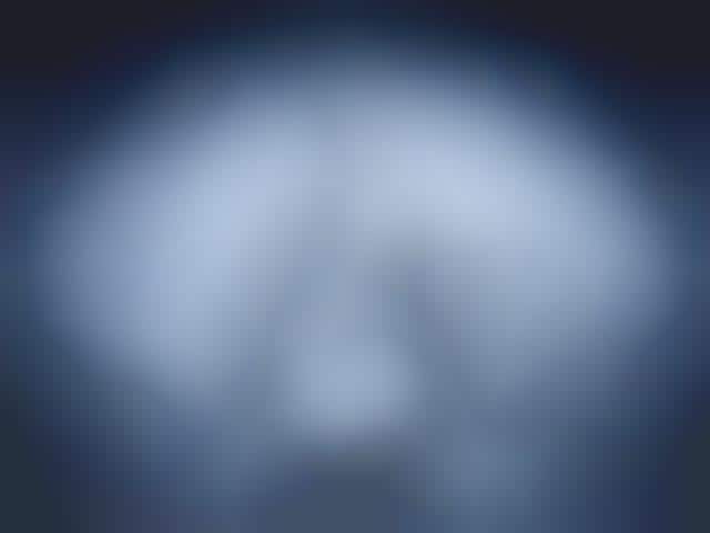 99 See-Through Creations