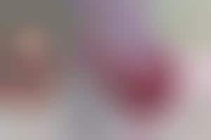 Fish-Inspired Fashion: Siamese Fighting Fish Dresses at Rodarte