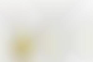 Dental Thumb Tacks : Tooth Push Pins