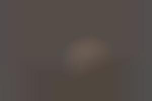 Medication Side Effect Ads : Kentera Oxybutynin Transdermal Patch