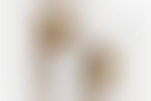 Charitable Gold Earbuds : gold apple earpods