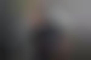 Prosthetic Musical Instruments : Prosthetics for Amputees