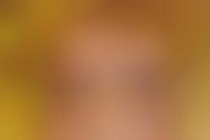 Eye & Lip Sewing: Frankenstein Face Mod