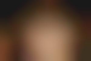 Belly Button Removal: The Latest in Radical Body Modification