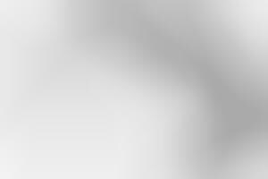 3D-Printed Knee Replacements : ConforMIS