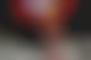 Faceless Therapy Cats: Chase Helps Disfigured Humans Heal