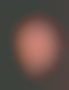 Body Rivets: Wildcat Skindiver Implants