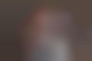 Plastic Surgery for Puppies: World's First Dog Face Transplant Performed