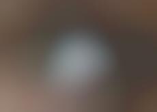 Eyeball Piercings: The JewelEye Punctures Your Sclera