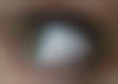 Eyeball Piercings: The JewelEye Punctures Your Sclera