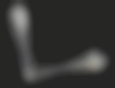 Hike-Enabling Prosthetic Legs : leg concept