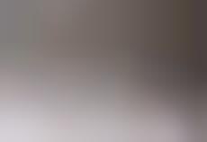 Apple Cell-Based Implants : human ear