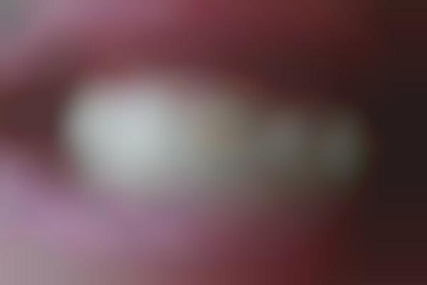 In-Mouth Tracking Wearables : Tooth-Mounted Sensor