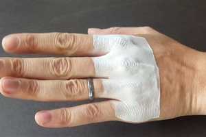 Custom-Printed Bandages : 3D Printed Bandages