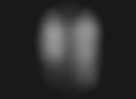 X-Ray Vision Sees Through Clothing: