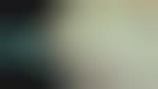 Freaky Subdermal Implants: Body Mods That Literally Get Under Your Skin