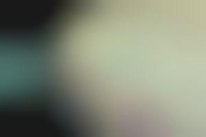 Freaky Subdermal Implants: Body Mods That Literally Get Under Your Skin