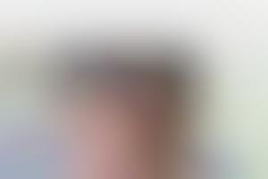 Male Face Transplants: James Maki is First Man to Receive a New Face