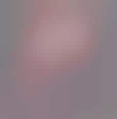 Freaky Foot Sites: 'Missing Toes' Honors Digit Amputees