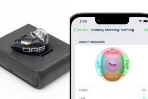 App-Connected Mouth Guards : ORB Smartguard