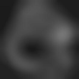 Intricate Underwater X-Rays : Fish Inside Out