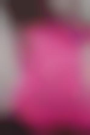 Fashionable Body Braces: ProAsthetics Support