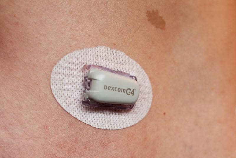 Continuous Glucose Monitors : dexcom