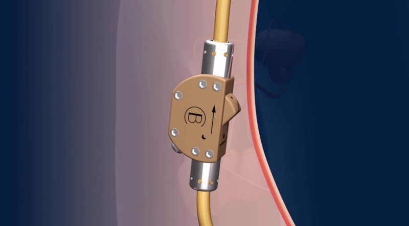 Male Contraception Gadgets : male birth control