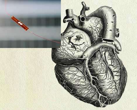 Heart-Powered Medical Devices : Heart Powered Medical Devices